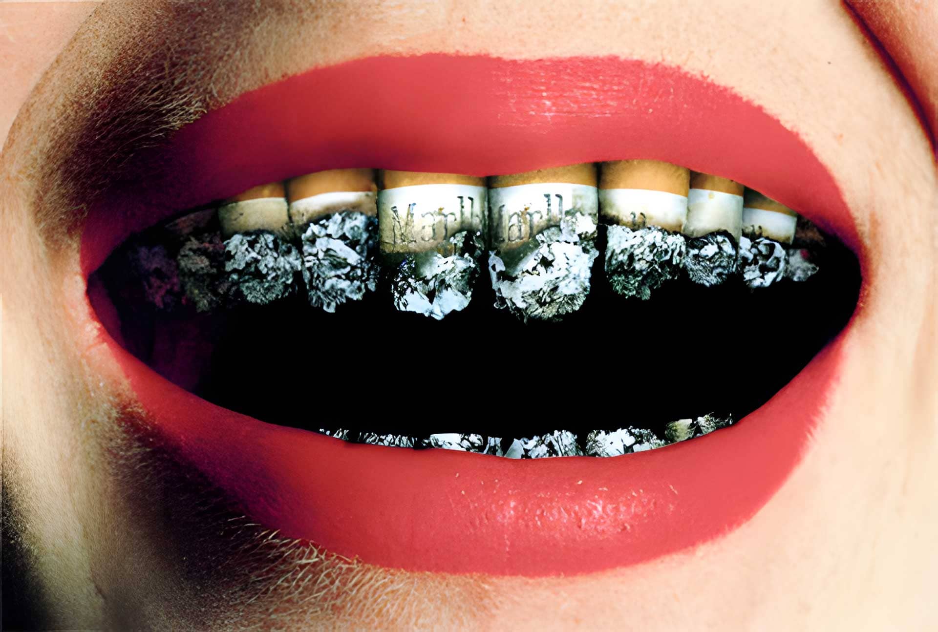 Smoking and Oral Health - Robina Family Dental